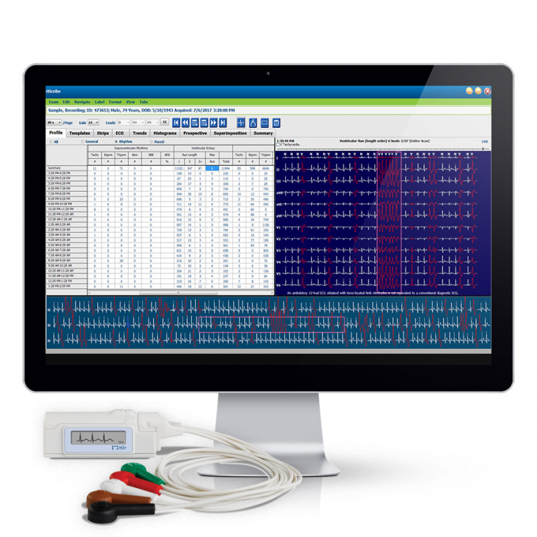Canine Holter Monitoring Services | AxisVet